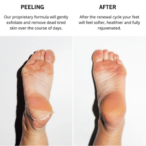 Foot Peel Mask Review 2025 - For Beautiful Clean Feet!