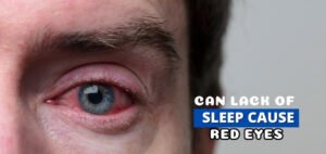 Can Lack of Sleep Cause Red Eyes?